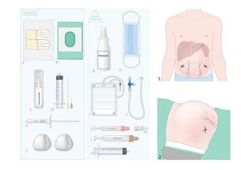Paracentesis Equipment