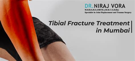 Treatments For Tibial Fracture In Mumbai Dr Niraj Vora