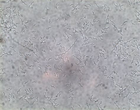 Esa Bacteria Through A Microscope