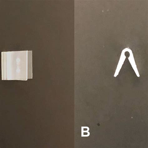 Intraoperative Photos Of A Pericardial Window With A Bactiseal Catheter