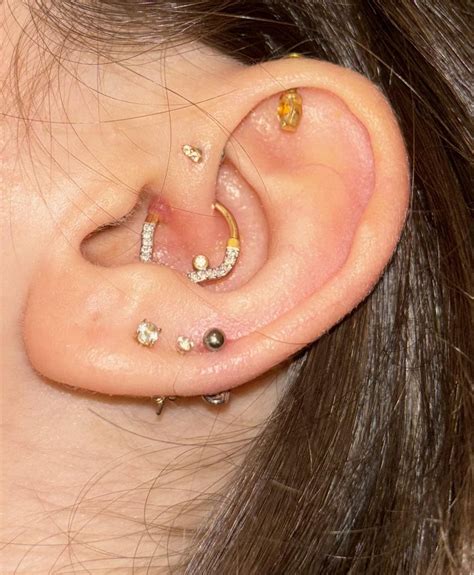 Stubborn Daith Bump Wont Go Away Rpiercingadvice