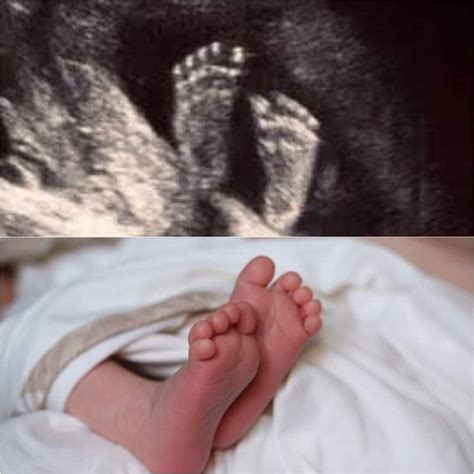 Өөлхөн үү 🥰 Манайд үзүүлдэг Армониа эмнэлэг 5d эхо