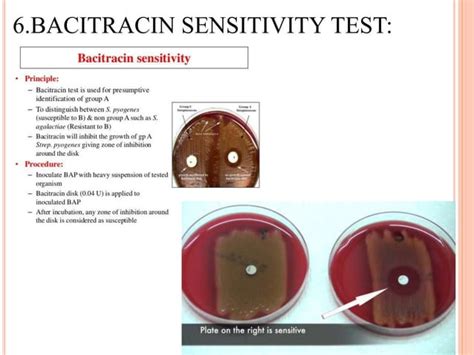 Isolation And Identification Of Staphylococcus Auerus Pptx
