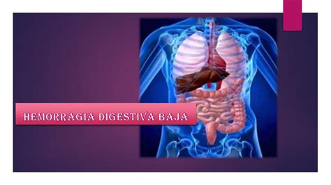 Hemorragia Digestiva