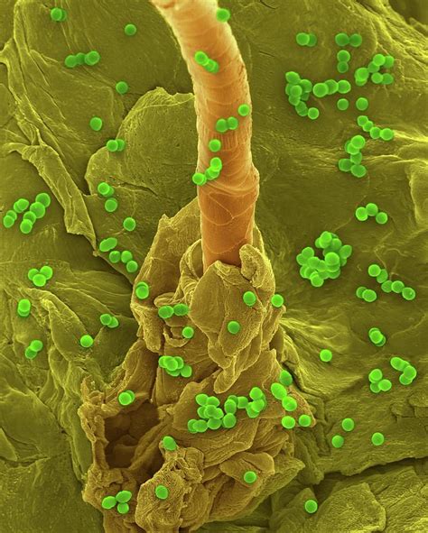 Enterococcus Faecium On Human Skin 1 By Science Photo Library