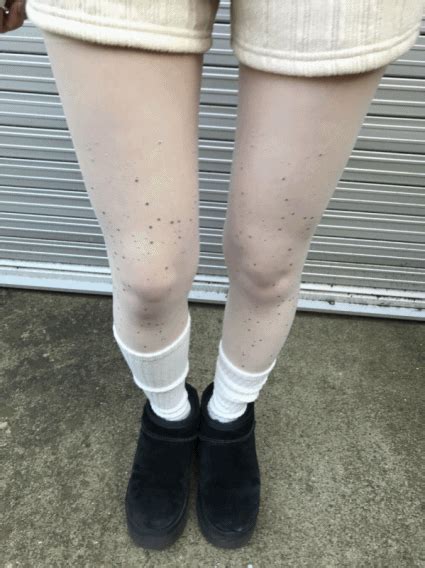 글리터 스타킹 에이블리