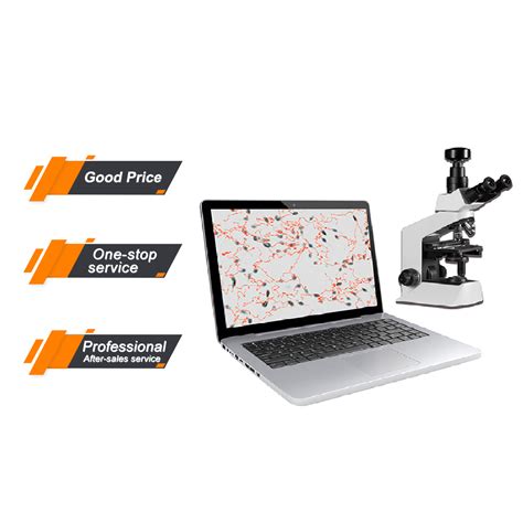 Ce Automatic Sperm Analyzer Sperm Analysis System Computer Assisted
