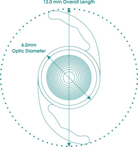 Trifocal Diffractive Refractive Hydrophobic Iol Freedom Ophthalmic