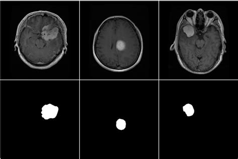 论文审查 Improved Unet Brain Tumor Image Segmentation Based On Gsconv