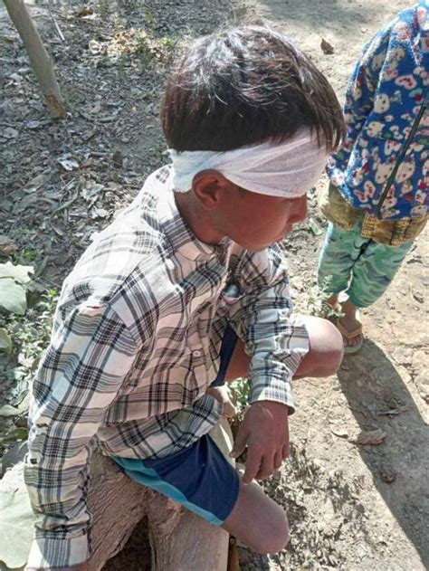 ရေစကြိုမြို့နယ်၊ သာဂေါင်ကျေးရွာကို စစ်တပ်က လေယာဉ်ဖြင့် ပေါင် ၅၀၀ ဗုံး ၂ လုံးကျဲချ တိုက် ခိုက်မှု