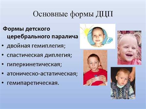 Детский церебральный паралич 7 ранних признаков 4 линии терапии