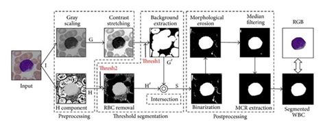Flowchart Of The Proposed Dual Threshold Segmentation Scheme Download Scientific Diagram