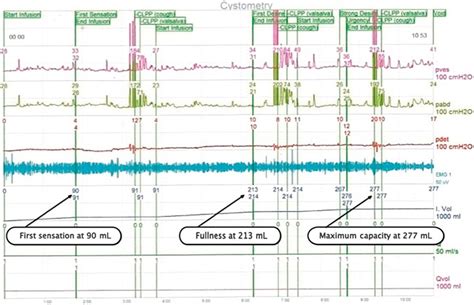 Urodynamics Indications Techniques Interpretation And Clinical