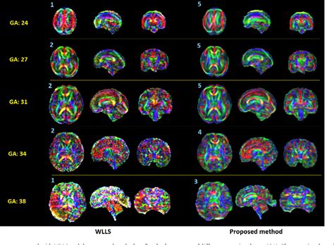 Figure 7 From Deep Learning Based Parameter Estimation In Fetal