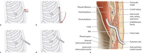 Neurovascular Systems Topographical Anatomy Basicmedical Key