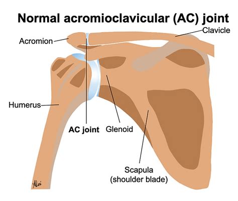 Acromioclavicular Joint Acj Cortisone Injection Pain Relief Uk