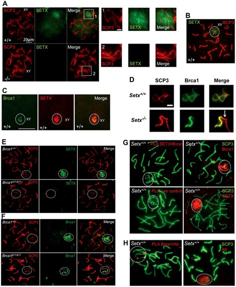 Senataxin Localises To The Sex Chromosomes During Meiosis A Staining Download Scientific