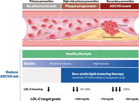 Evolving Management Of Low‐density Lipoprotein Cholesterol A Personalized Approach To