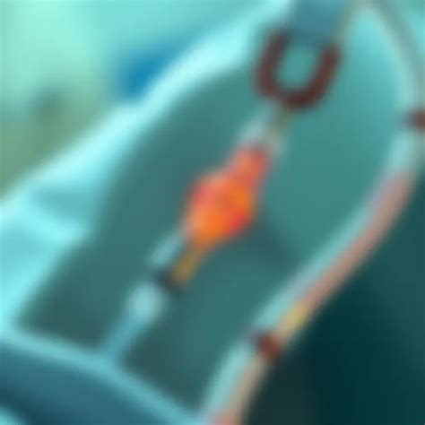 Exploring The Nicu Picc Line An In Depth Analysis