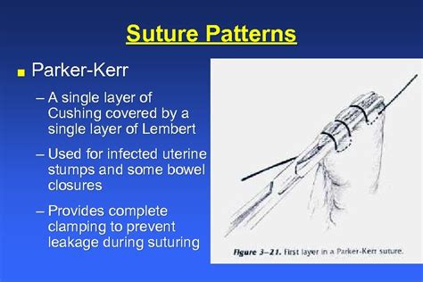 Wound Healing And Suture Knowledge Asr Certification Prep