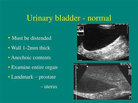 Urinary Bladder Distended