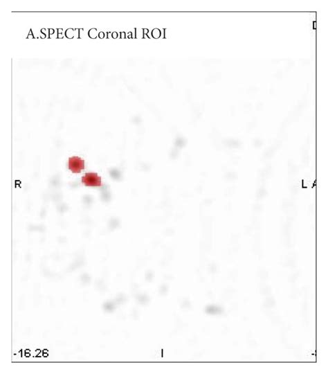 Graphical Images Describing The Semiautomatic Segmentation For The Download Scientific Diagram