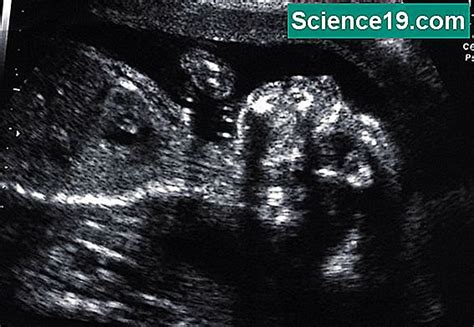 Anatomske Strukture Homologne Analogne And Vestigial 💫 Znanstveno Popularni Multimedijalni