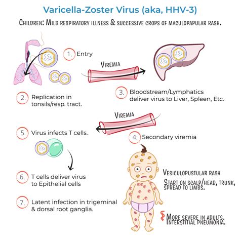Varicella Zoster Virus Immunity To Varicella Zoster Virus In