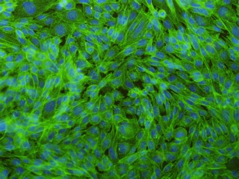 细胞骨架的荧光观察 细胞生物学实验 哔哩哔哩