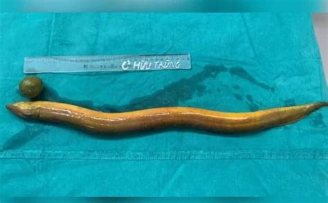 Indian Man Almost Dies After Inserting 65cm Long Eel Up His Anus To Seek Sensations Trending