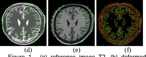 Figure 1 From Multimodal Medical Image Elastic Registration Using Mean Shift Semantic Scholar