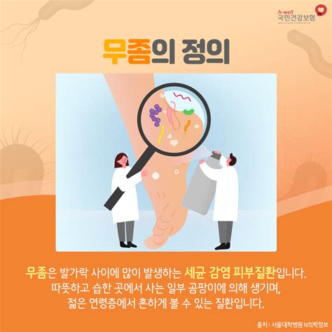 국민건강보험 [ 건강의식주] 발가락이 간질간질 점점 갈라지는 이유는 누구에게나 찾아올 수