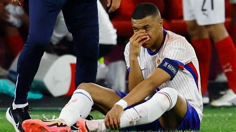 Euro 2024 France Captain Kylian Mbappe Suffers Broken Nose During Victory Opener Against
