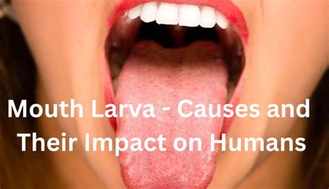 Mouth Larva Understanding The World Of Oral Infestations