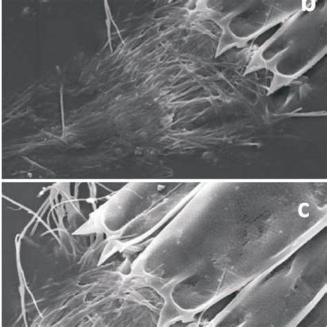 Morphological Details Of The Undescribed Species Of Spinoloricus Download Scientific Diagram