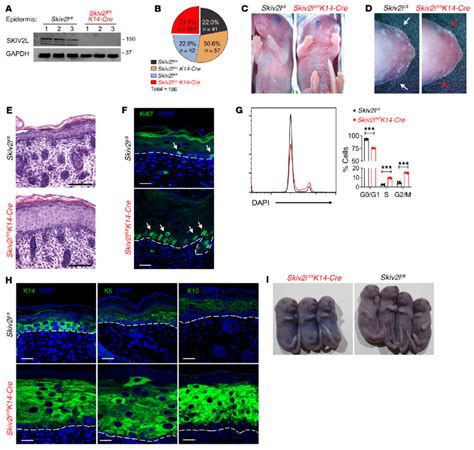 Epidermal Hyperproliferation In Germline Keratinocyte Specific Skiv2l