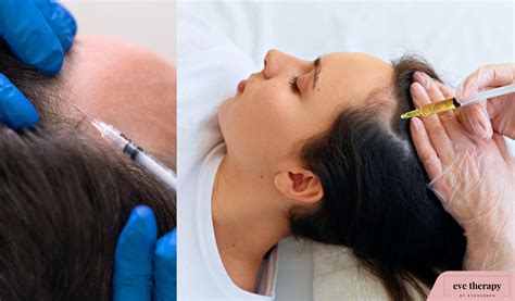 How PRP Works Eve Therapy