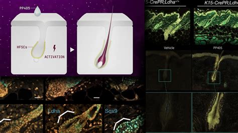 Pp405 Phase 2a Results Anticipation [adhoc Reaction] Youtube