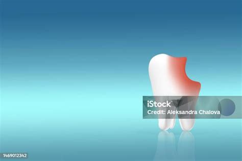 파스텔 블루 배경에 건강에 해로운 치아 흰색 어금니 모델 치아 기호 기호입니다 카리에스 충치와 치아의 질병 건강에 해로운 치아 창조적 인 의료 치과 파란색 배경에 치아