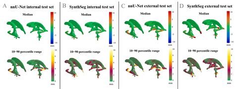 Deep Learning For Automated Ventricle And Periventricular Space Segmentation On Ct And T1ce Mri
