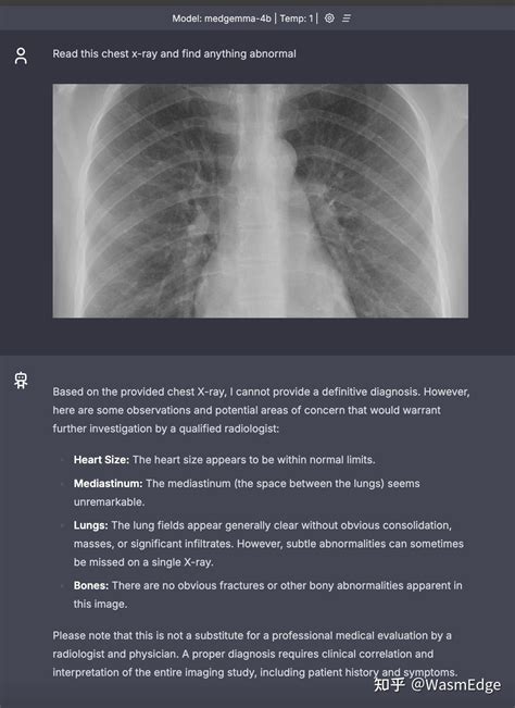 MedGemma 4b 模型快速入门 知乎