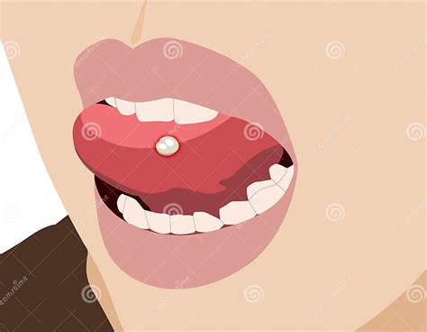 Aphthae Or Aphtha Tongue Close Up Unhealthy In Oral Illustration Cartoon Stock Illustration