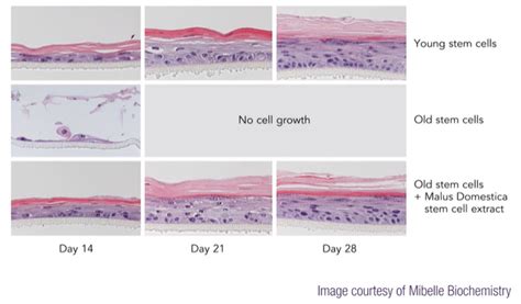 Stem Cells In Cosmetic Formulas A Sustainable Innovation In