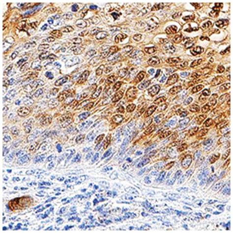 Human Galectin 7 Antibody R D Systemsantibodiesprimary Antibodies