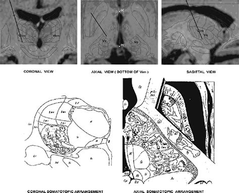 Principles Of Extracellular Single Unit Recording Neupsy Key
