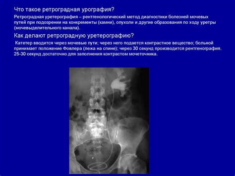 Рентгендиагностика заболеваний почек и мочевыделительных путей Online Presentation