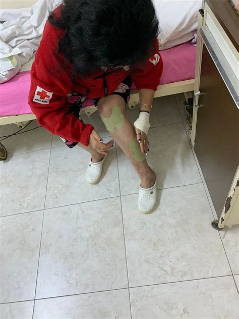 Натурални Билкови Пластири при болки в коленете