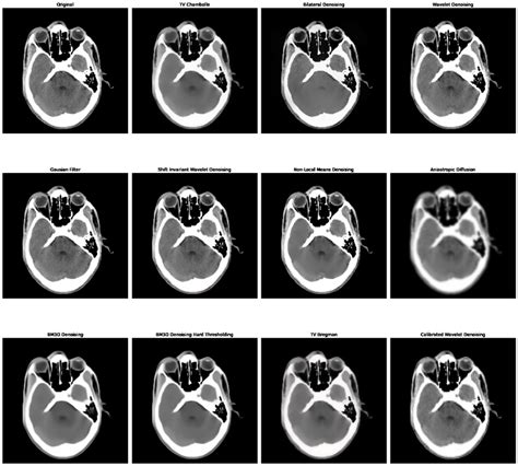 Visualization Of An Original Random 2d Slice After Performing Denoising