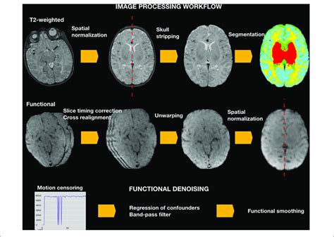 Neors Workflow For Neonatal Resting State Functional Connectivity Download Scientific Diagram