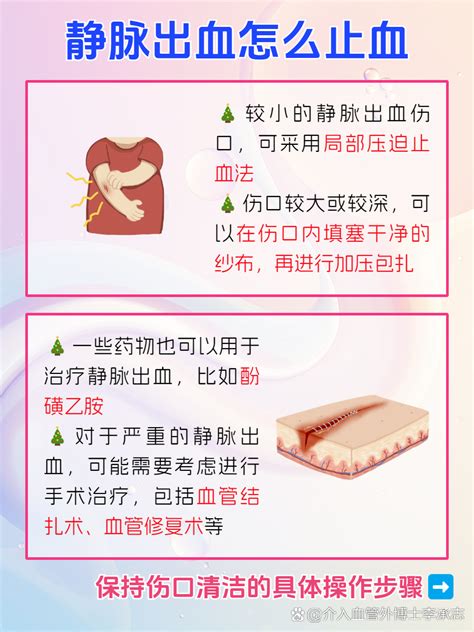 静脉出血怎么止血？